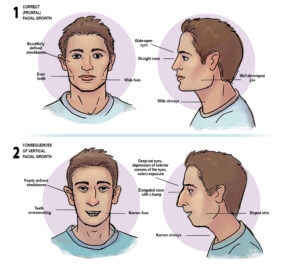 Myofunctional Therapy - Face Fitness OMT